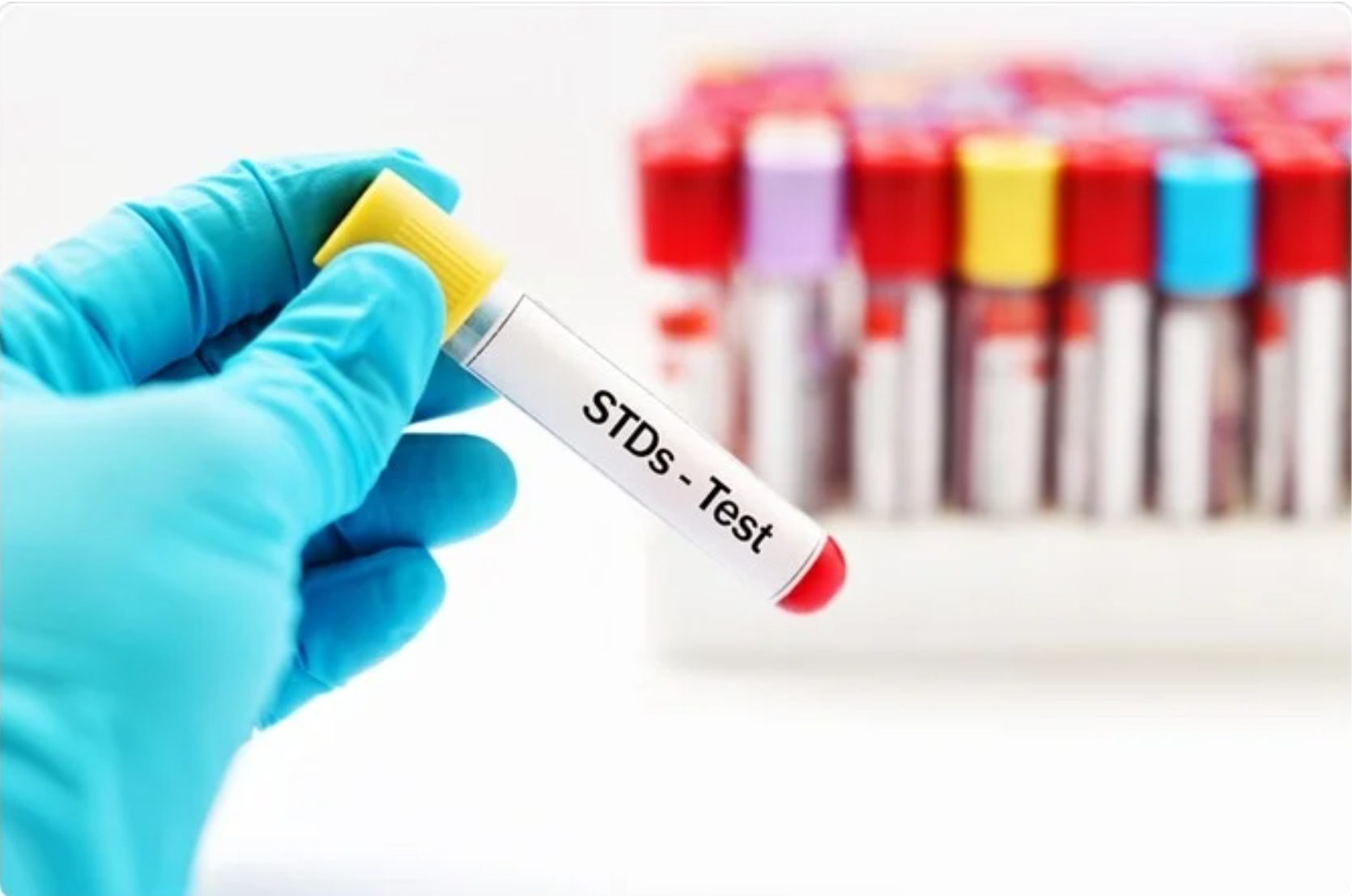 Richland County sees drop in sexually transmitted diseases since 2019